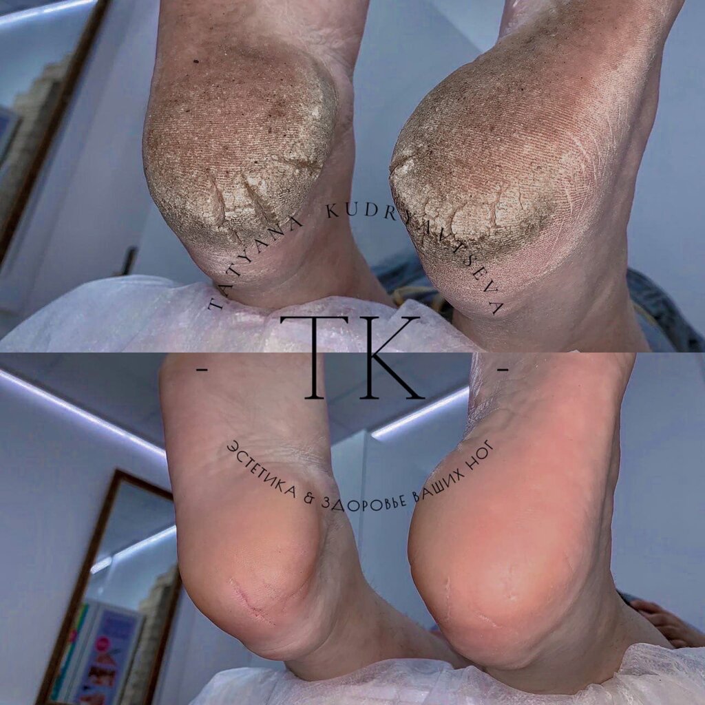 Manikür-pedikür Podo_st Cherepovets, Cherepovets, foto