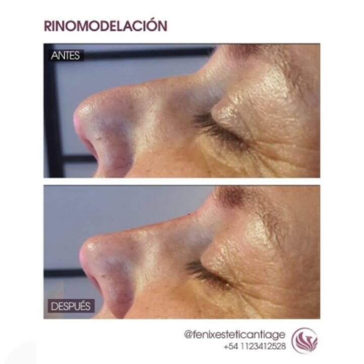 Tıp merkezleri ve klinikler Fénix Antiage Dr. Santiago Baldoni, Buenos Aires, foto