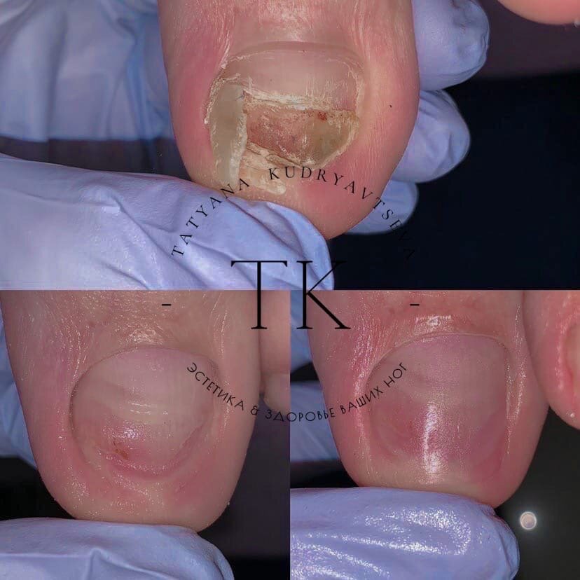 Manikür-pedikür Podo_st Cherepovets, Cherepovets, foto