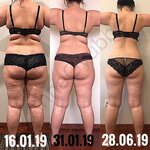Pigmalion. SPb body and face correction Studio (Priozerskoe Highway No:14к6), güzellik salonu  Saint‑Petersburg'dan