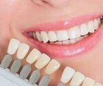 Studio Dentistico Dott. Generoso Morrone (Via Mazzini No:48, Eboli, Battipaglia), özel ağız ve diş sağlığı klinikleri ve muayenehaneleri  Campania'dan