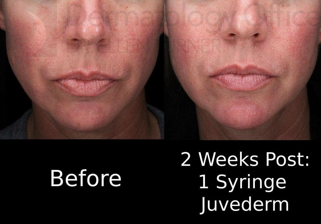 Kozmetoloji, kozmetik salonları Dermatology Office, Dallas, foto