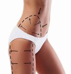 Clinicagostini (Via Dante No:12, Bolzano, la città di Bolzano), plastik cerrahi klinikleri  Bolzano'dan