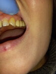 Блеск (Institutskaya ulitsa No:4), özel ağız ve diş sağlığı klinikleri ve muayenehaneleri  Puşçino'dan