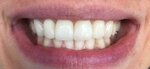 Studio Dentistico Pagano (Via Fabrizi No:215, Montesilvano), özel ağız ve diş sağlığı klinikleri ve muayenehaneleri  Abruzzo'dan