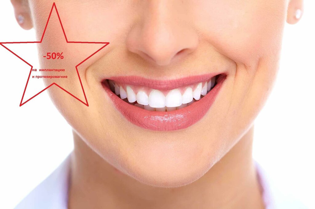 Özel ağız ve diş sağlığı klinikleri ve muayenehaneleri Implant58 Stomatologiya Skuridina, Penza, foto