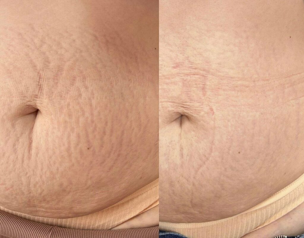 Kozmetoloji, kozmetik salonları Plazmausova, Çeliabinsk, foto