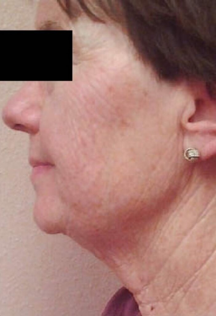 Spa UltraSlim by Mk, Missisippi Eyaleti, foto