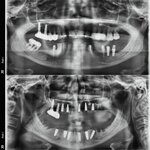 Dental Expert Diş Kliniği (Antalya, Alanya, Mahmutlar Mah., Öğretmen Ahmet Keşoğlu Sok., 9), özel ağız ve diş sağlığı klinikleri ve muayenehaneleri  Alanya'dan