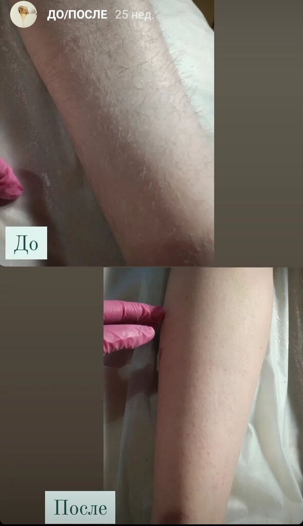 Ağda Шугаринг, Moskova ve Moskovskaya oblastı, foto