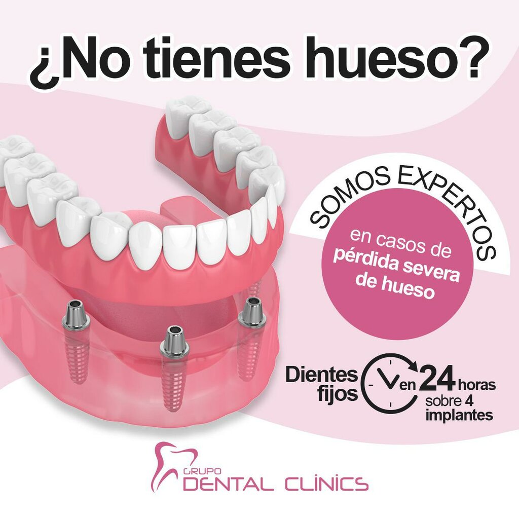 Özel ağız ve diş sağlığı klinikleri ve muayenehaneleri Grupo Dental Clinics Fuengirola, , foto