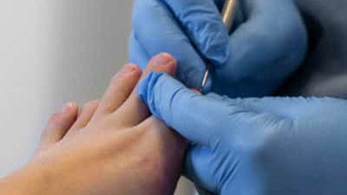 Manikür-pedikür Klinik for Fodterapi v Inger Johansen, Güney Danimarka, foto