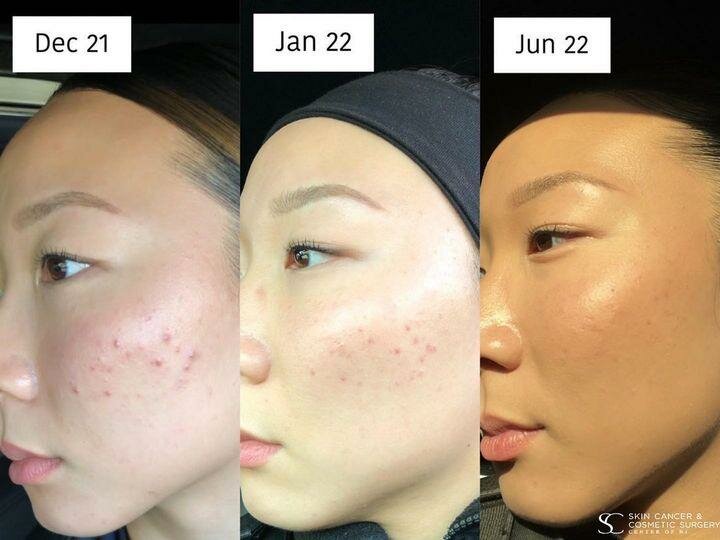 Tıp merkezleri ve klinikler Skin Cancer & Cosmetic Surgery Center of Nj - Dr Adriana Lombardi, New Jersey Eyaleti, foto