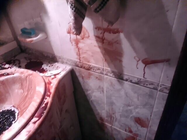 Temizlik şirketleri Limpiezas forenses Granada - Limpiezas síndrome de Diógenes, Granada, foto