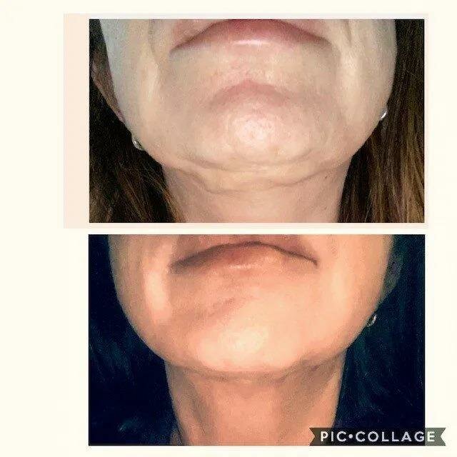 Spa Luxe Medical SPA, Texas, foto
