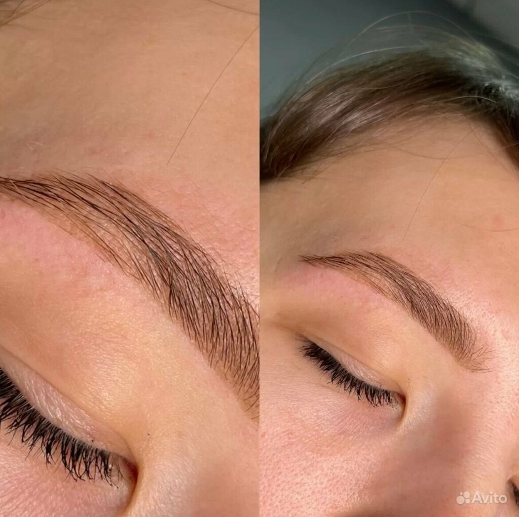 Epilasyon Laser. Brows, Kstovo, foto