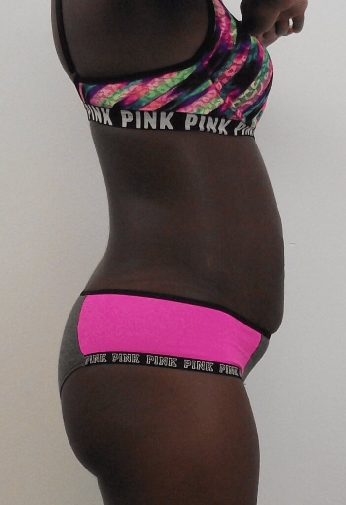 Spa UltraSlim by Mk, Missisippi Eyaleti, foto