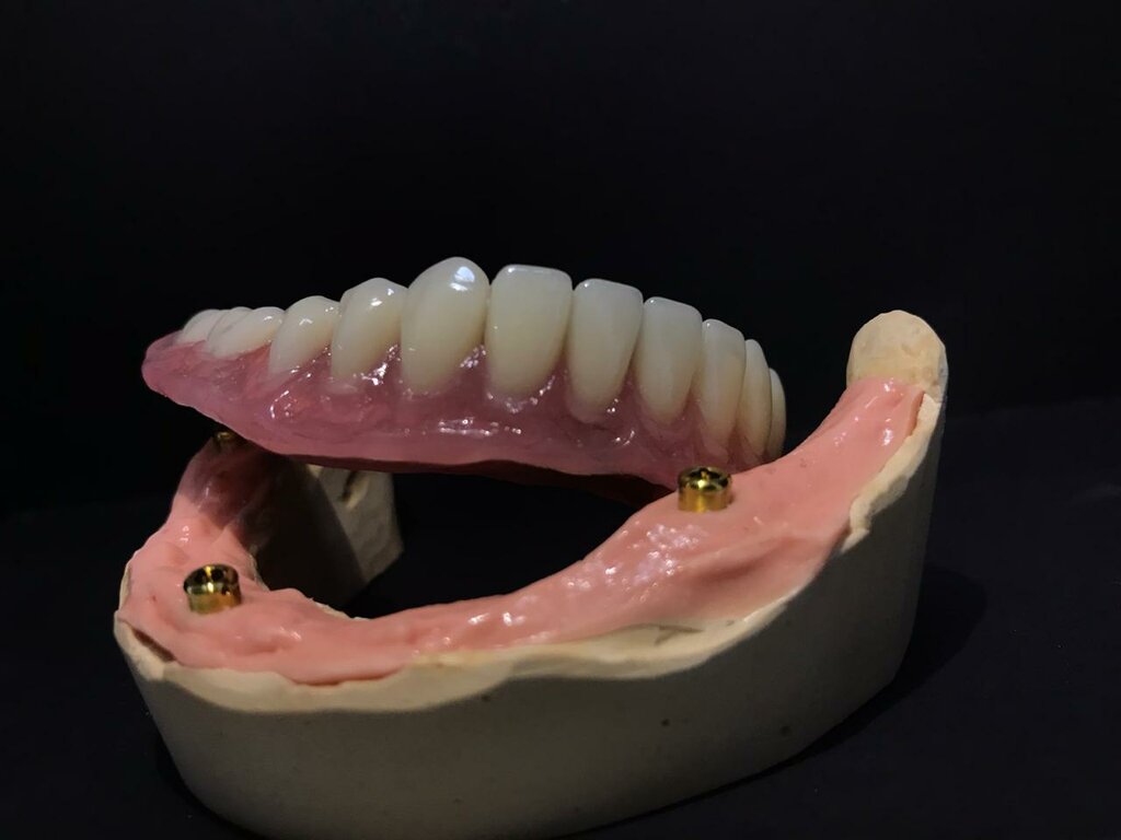 Özel ağız ve diş sağlığı klinikleri ve muayenehaneleri Dr. Radjabov, Dagestanskie Ogni, foto