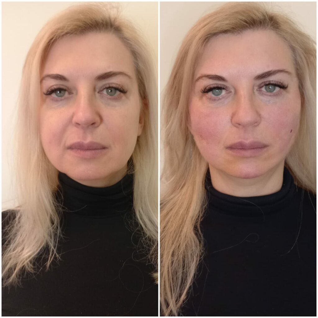 Kozmetoloji, kozmetik salonları Dr. Lana, Moskova, foto