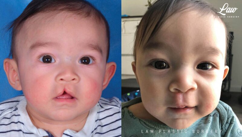 Plastik cerrahi klinikleri Huay-Zong Law, Md - Law Plastic Surgery, Dallas, foto