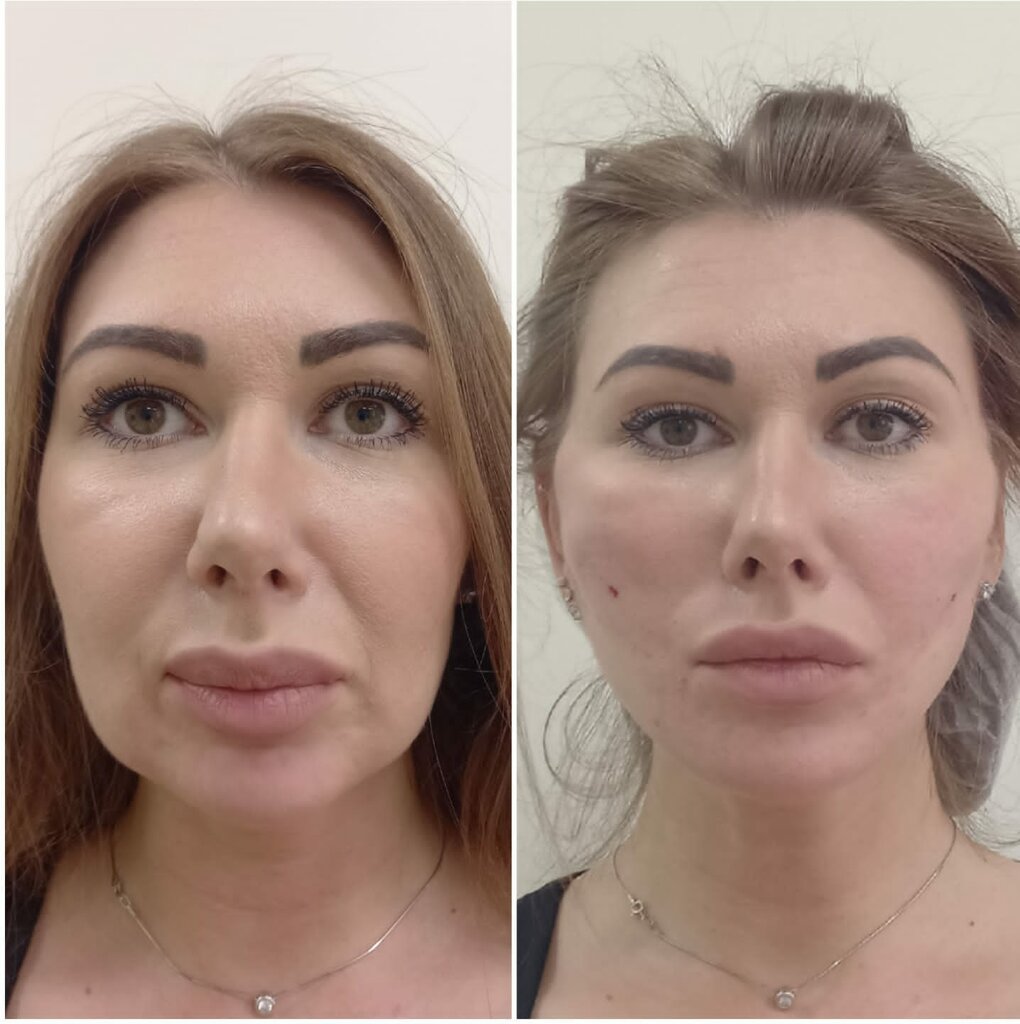 Kozmetoloji, kozmetik salonları Dr. Lana, Moskova, foto