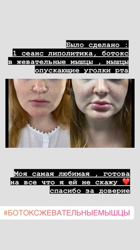 Kozmetoloji, kozmetik salonları GlowSkin, Moskova, foto