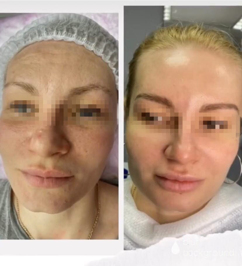 Kozmetoloji, kozmetik salonları GlowSkin, Moskova, foto
