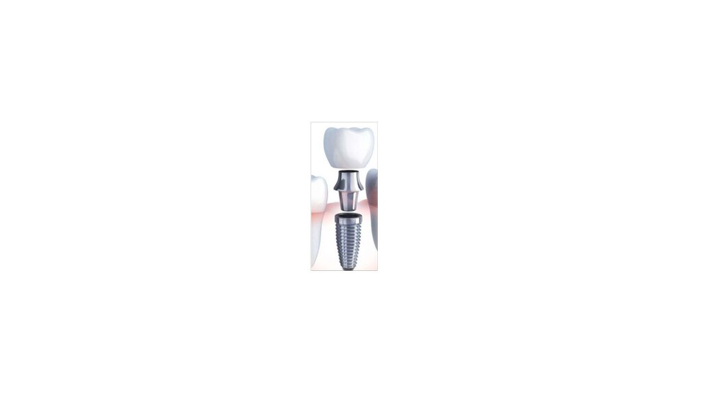 Hastaneler Soluciones Dentales Especializadas, Managua, foto