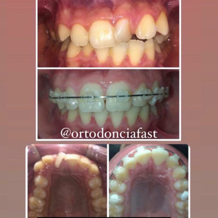 Özel ağız ve diş sağlığı klinikleri ve muayenehaneleri Ortodoncia Fast, , foto