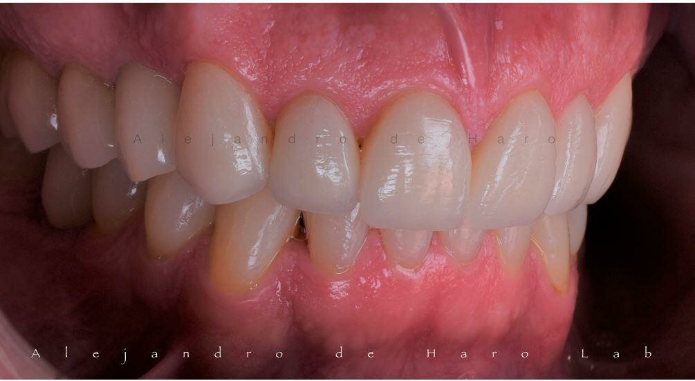 Özel ağız ve diş sağlığı klinikleri ve muayenehaneleri Digitalis Estudio Dental, Malaga, foto