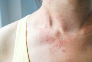 Dra. Corona Lila Inés - Alergia E Inmunología (Departamento Capital, San Juan, Mendoza), tıp merkezleri ve klinikler  San Juan'dan
