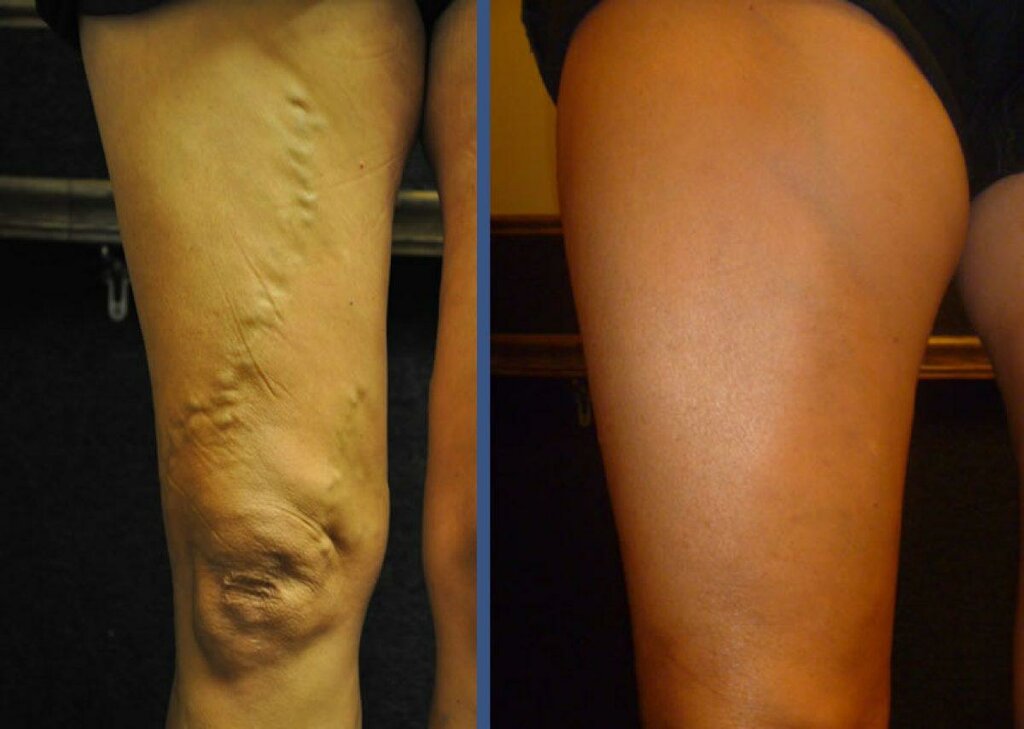 Ortopedik ürünler Jack B. Perlmutter, Md, Faaos Abos, Avlm, İllinois, foto