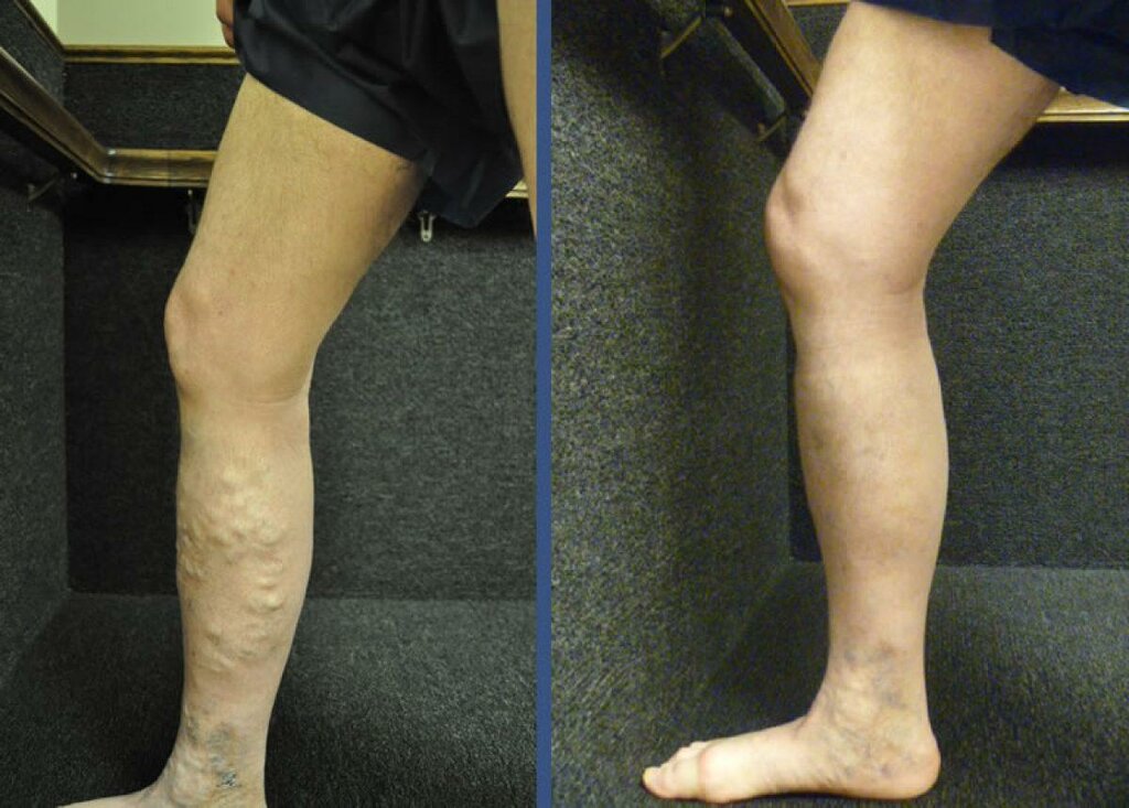 Ortopedik ürünler Jack B. Perlmutter, Md, Faaos Abos, Avlm, İllinois, foto