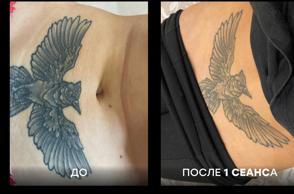 Dövmeciler Kasatkin Lazer, Moskova, foto