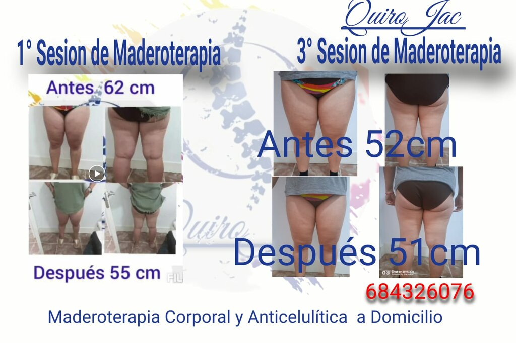 Tıp merkezleri ve klinikler Quiromasajista Jac Quirojac, Murcia, foto