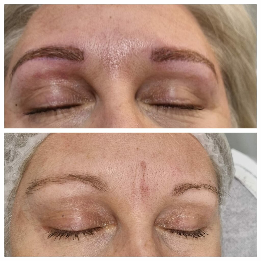 Güzellik salonu Micropigmentación Lleida - Dermapen LLeida - Montse Martinez, Lleida, foto