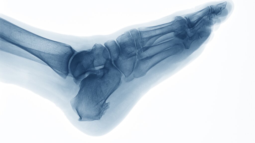 Özel muayenehaneler Podiatry Associates of Cincinnati, Ohio Eyaleti, foto