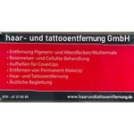 Haar- und tattooentfernung GmbH (Neue Brücke No:3, Stuttgart), kuaförler  Stuttgart'tan
