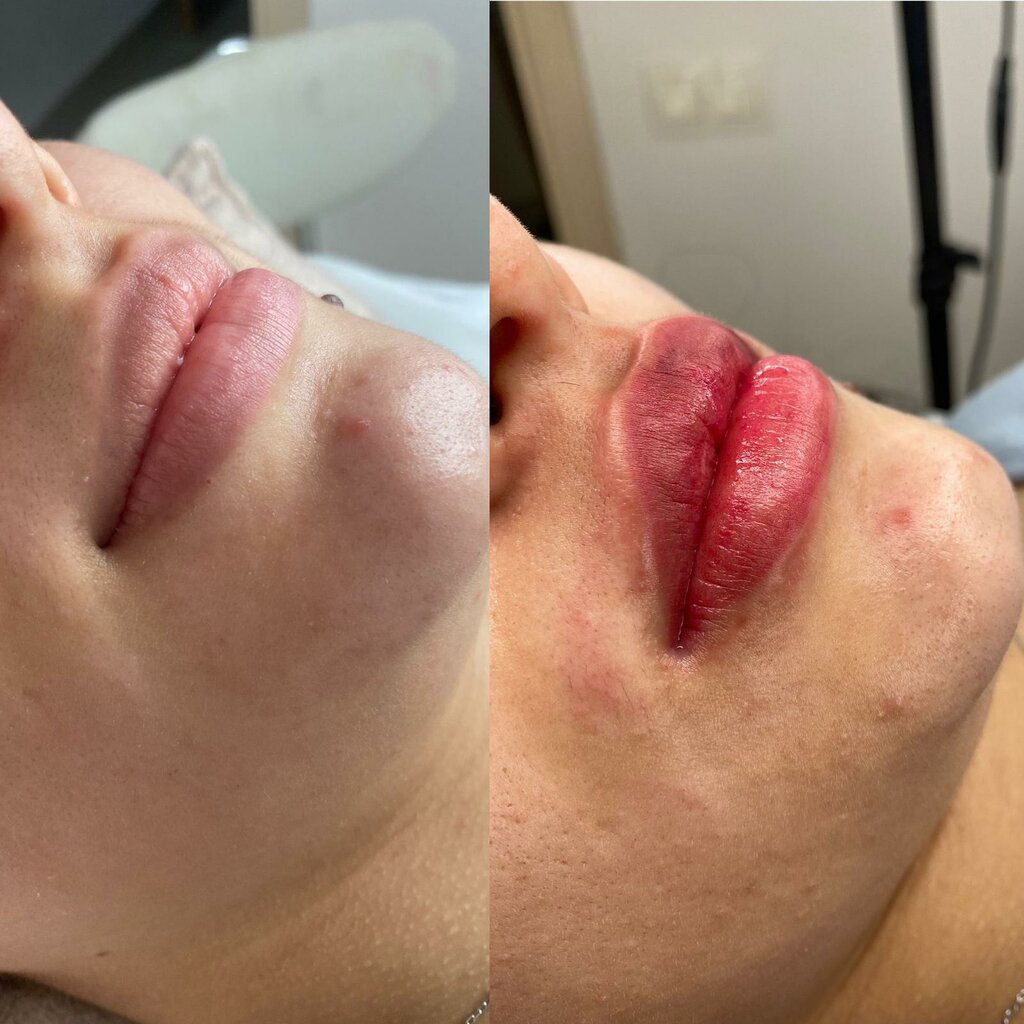 Güzellik salonu Maderoterapia San Vicente del Raspeig - Microblading San Vicente del Raspeig - Mia Magic, Valensiya, foto