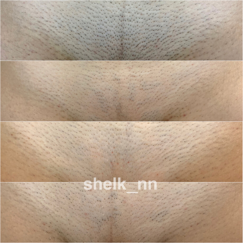 Epilasyon Shelk_nn, Nijni Novgorod, foto