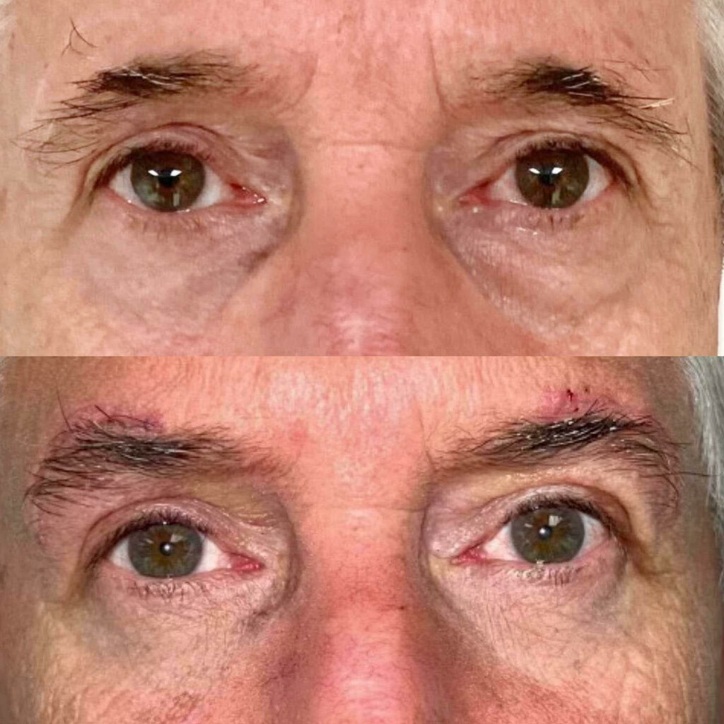 Plastik cerrahi klinikleri Dr. Bryan Costin, Ohio Eyaleti, foto