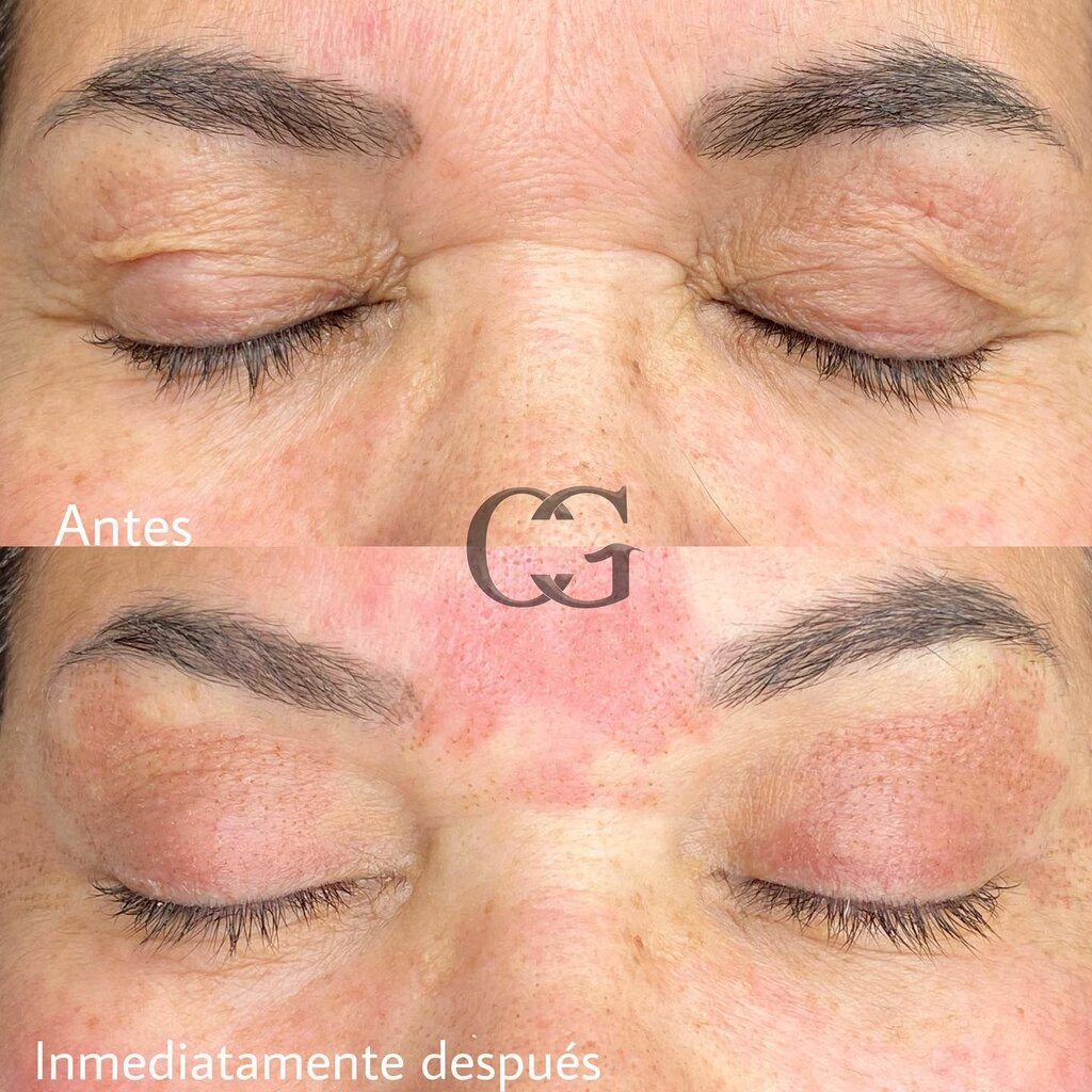 Plastik cerrahi klinikleri Micropigmentación Torrelavega - Microblading Cantabria - CG Brows & Beauty, Kantabria, foto