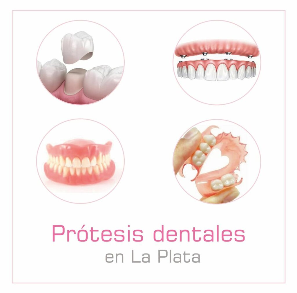 Özel ağız ve diş sağlığı klinikleri ve muayenehaneleri Odontología de Estética Avanzada, La Plata, foto