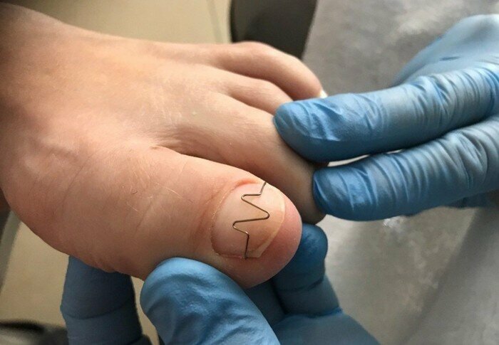 Podoloji Futmaster, Tiumen, foto