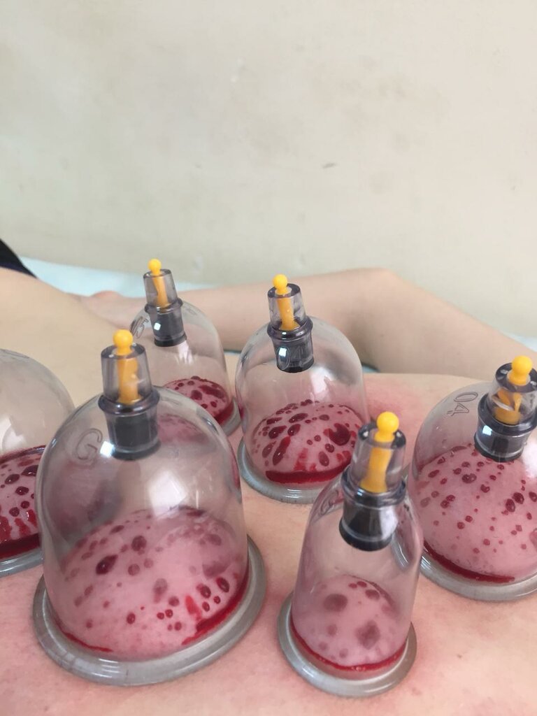 Kozmetoloji, kozmetik salonları Hijama Girl, Nalchik, foto