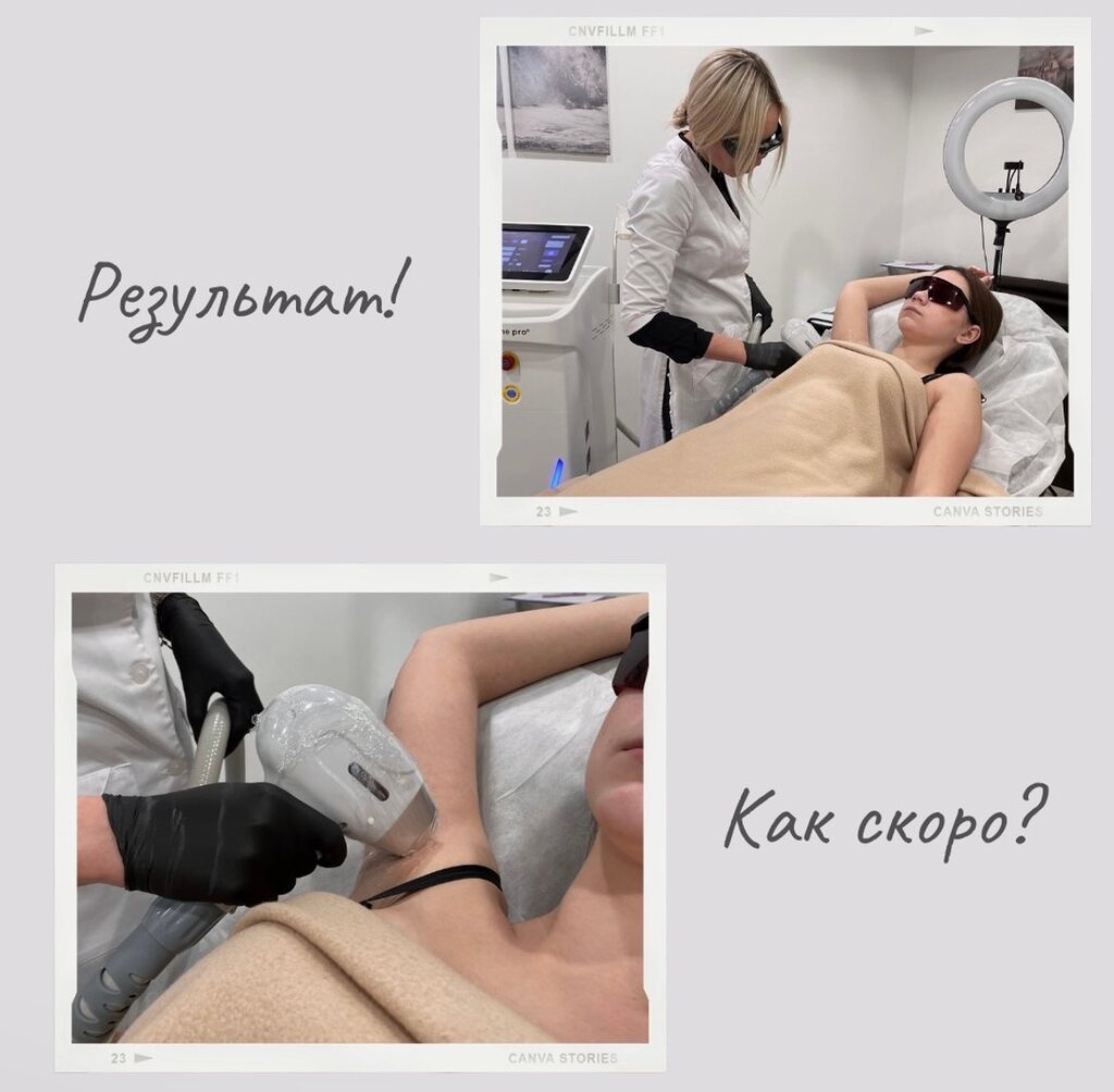 Epilasyon Selena, Moskova, foto