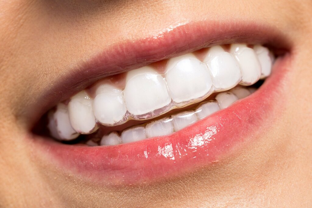 Özel ağız ve diş sağlığı klinikleri ve muayenehaneleri Infinity Dental Center, Dubai, foto