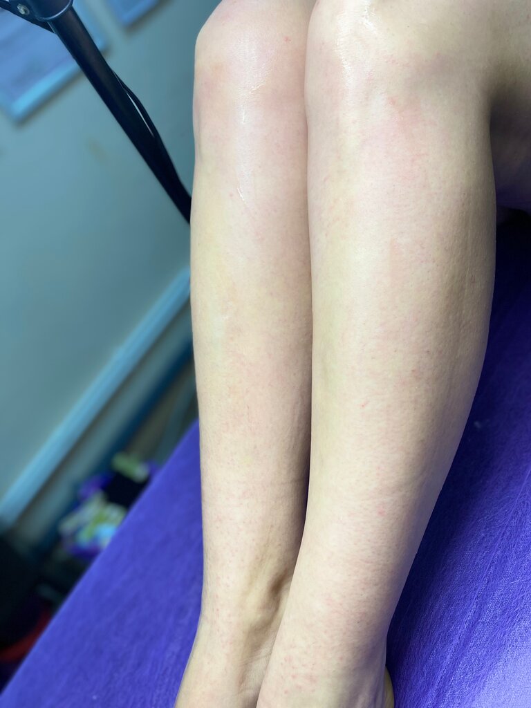 Ağda Студия Шугаринга Elit Epil, Kamensk‑Şahtinski, foto