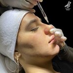 Dott. ssa Livia Stellin - Medico Estetico (Piedmont, Novara, Via Nino Oxilia), plastik cerrahi klinikleri  Novara'dan