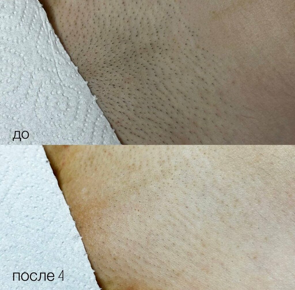 Epilasyon Estetic Lab by Irina Danilova, Kazan, foto